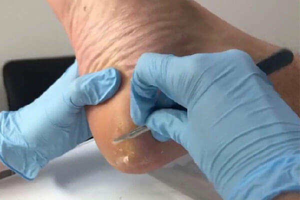 Routine Care - MK Feet Podiatry Clinic